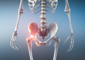 Pubalgia - Causas e Tratamentos - Instituto Reaction em São Paulo - SP