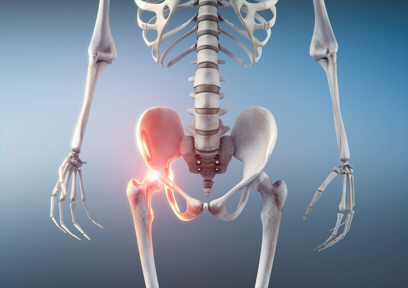 Pubalgia - Causas e Tratamentos - Instituto Reaction em São Paulo - SP