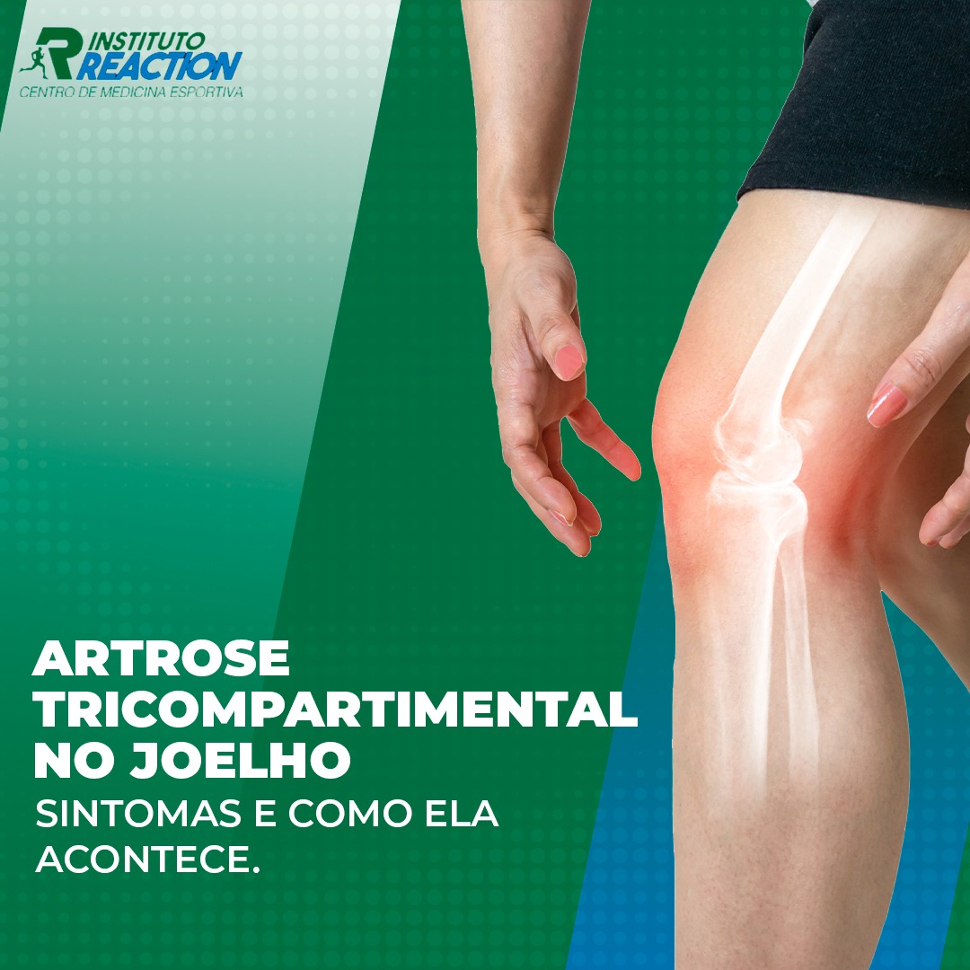 Artrose tricompartimental no joelho, sintomas e como ela acontece ...