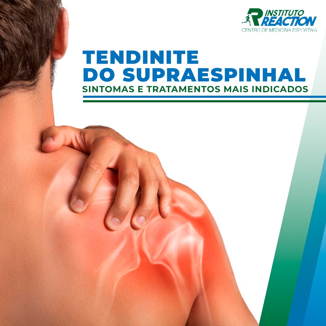 Leve Tendinopatia Do Supraespinhal - RETOEDU