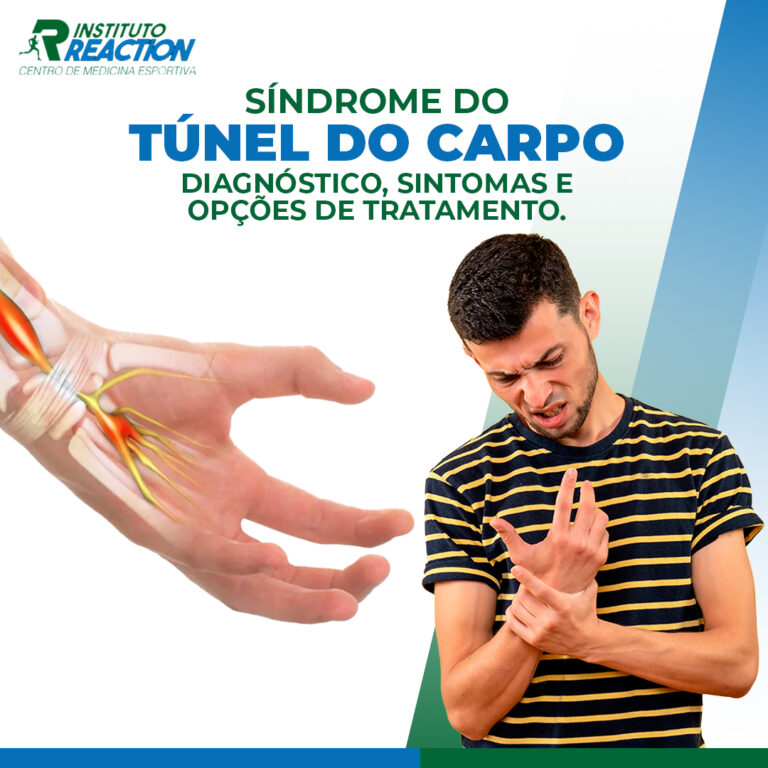 Síndrome do túnel do carpo: diagnóstico, sintomas e opções de tratamento