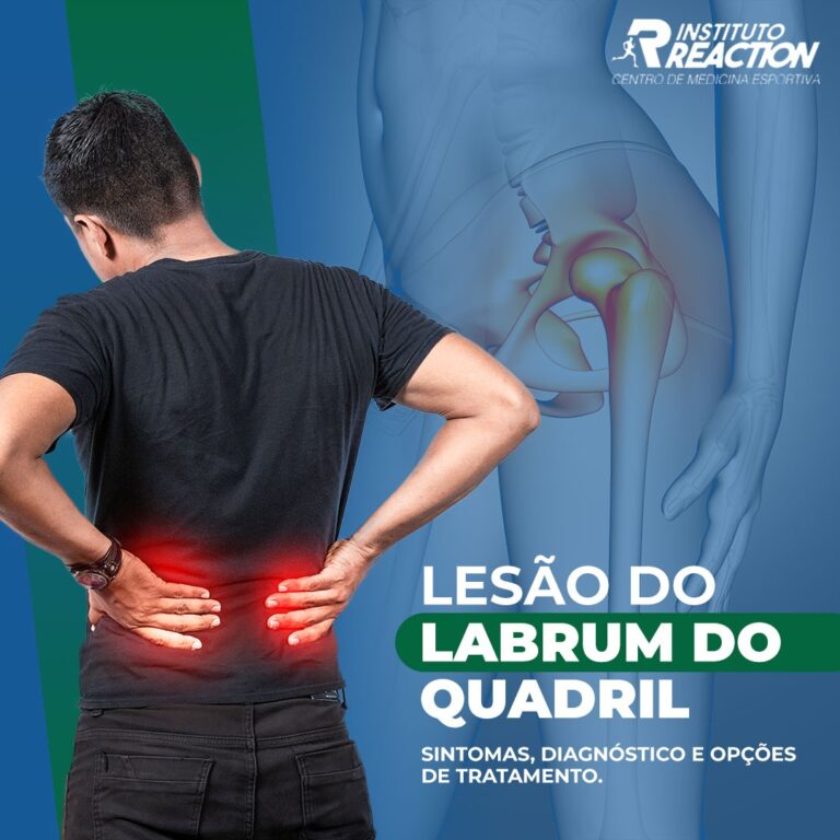 Lesão do labrum do quadril - Instituto Reaction